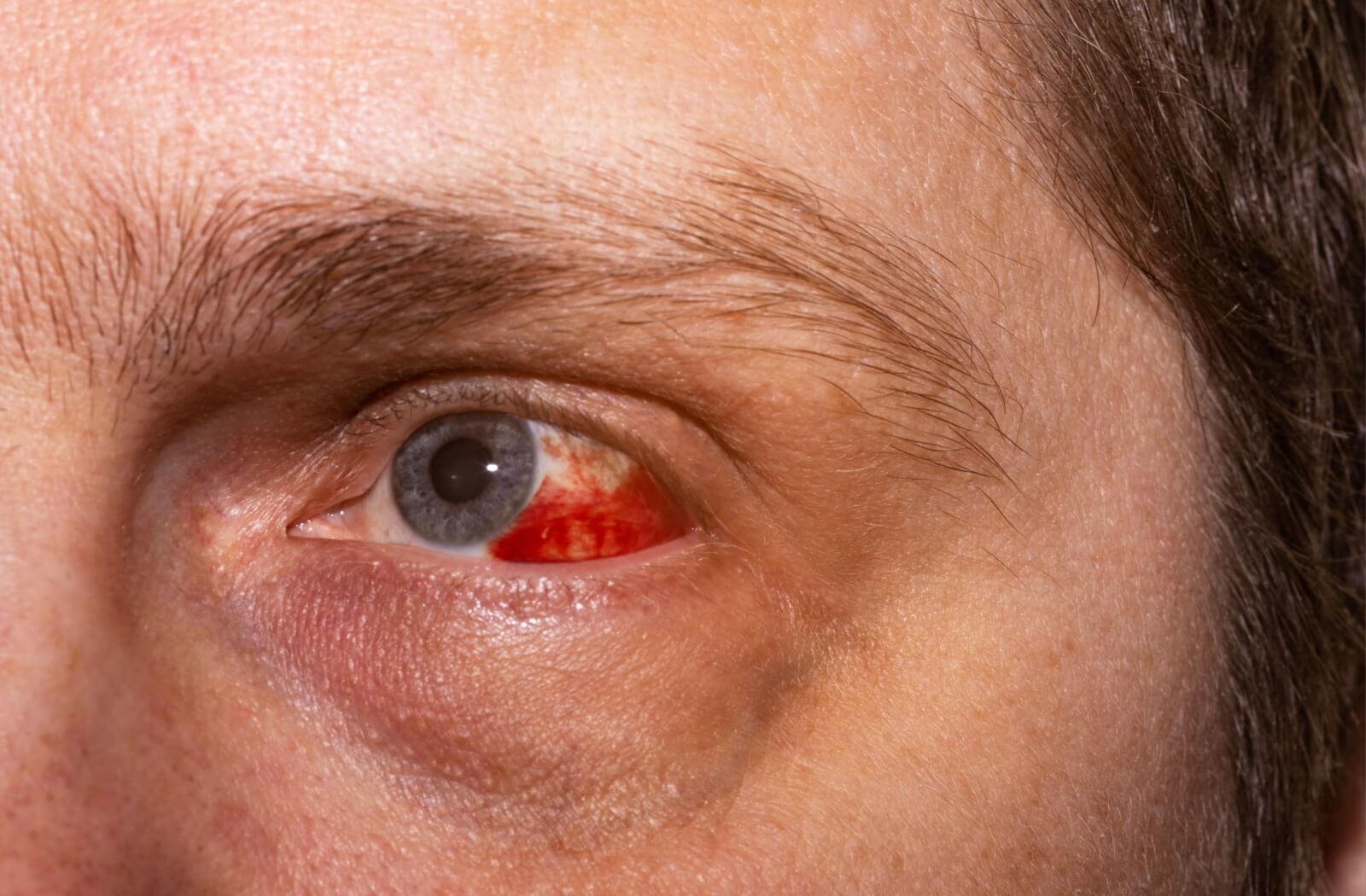 What Would Be Considered an Eye Emergency? | Arc Eye Care